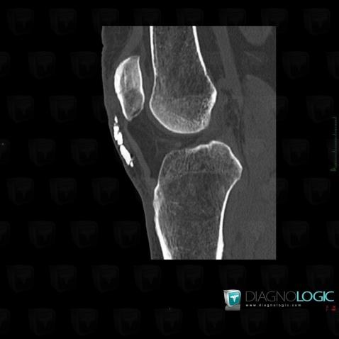 Cas radiologie : Sclérodermie (Scanner) - Diagnologic