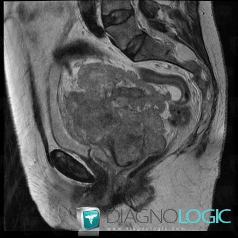 Cas radiologie : Métastase (IRM) - Diagnologic