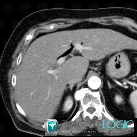 Radiology case : Postoperative (CT) - Diagnologic